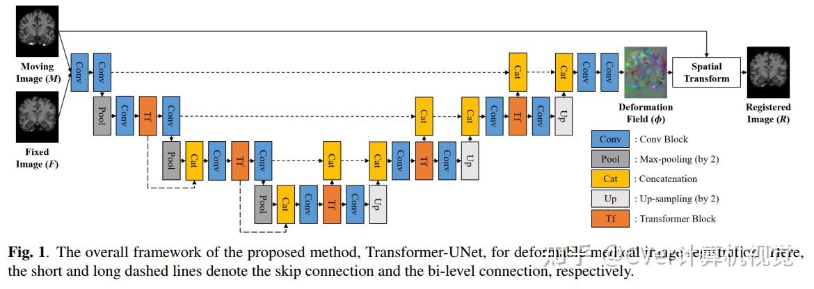 Transformer-UNet：基于Transformer的可变形医学图像配准网络 - 知乎