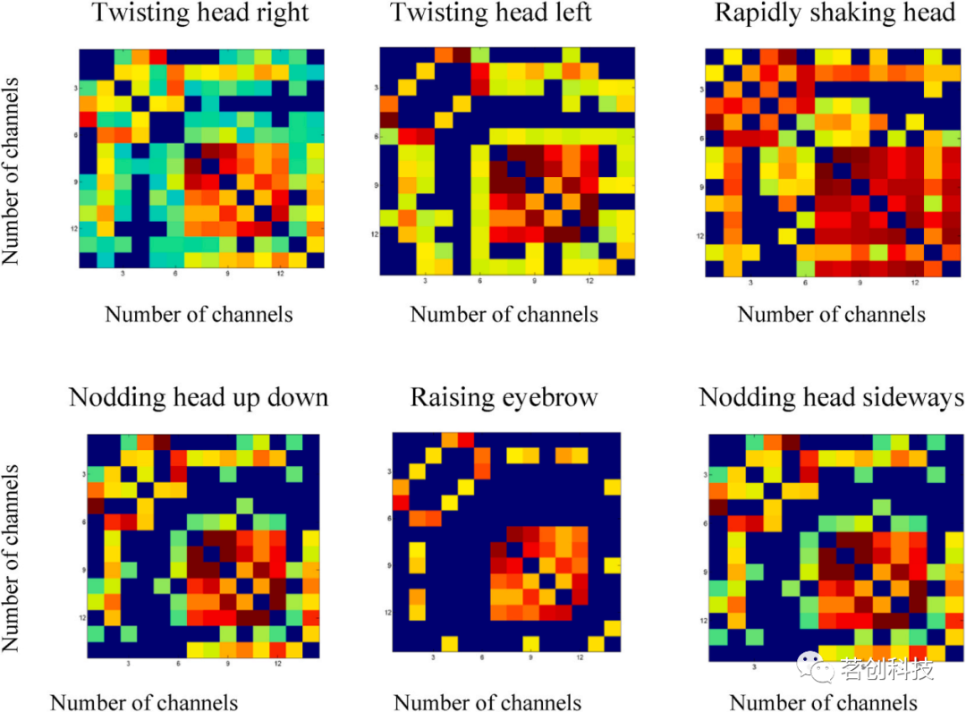 基于fNIRS的脑功能连接分析：图论方法 - 知乎