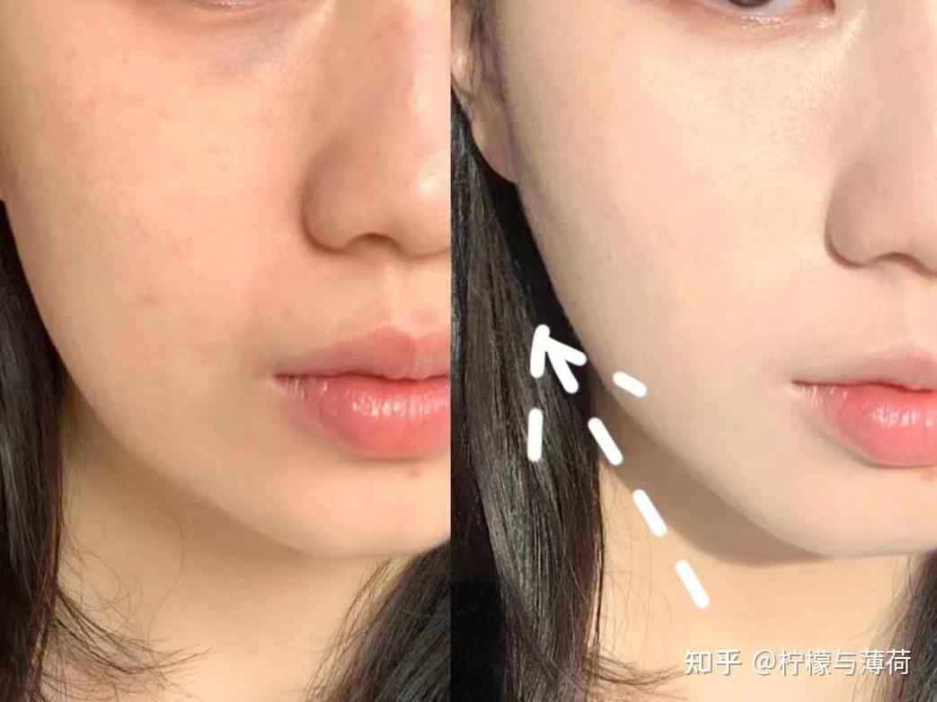 GEMO金茉美容仪好用吗？哪款最值得入手？内附GEMO金茉美容仪G20使用分享，买前必看！