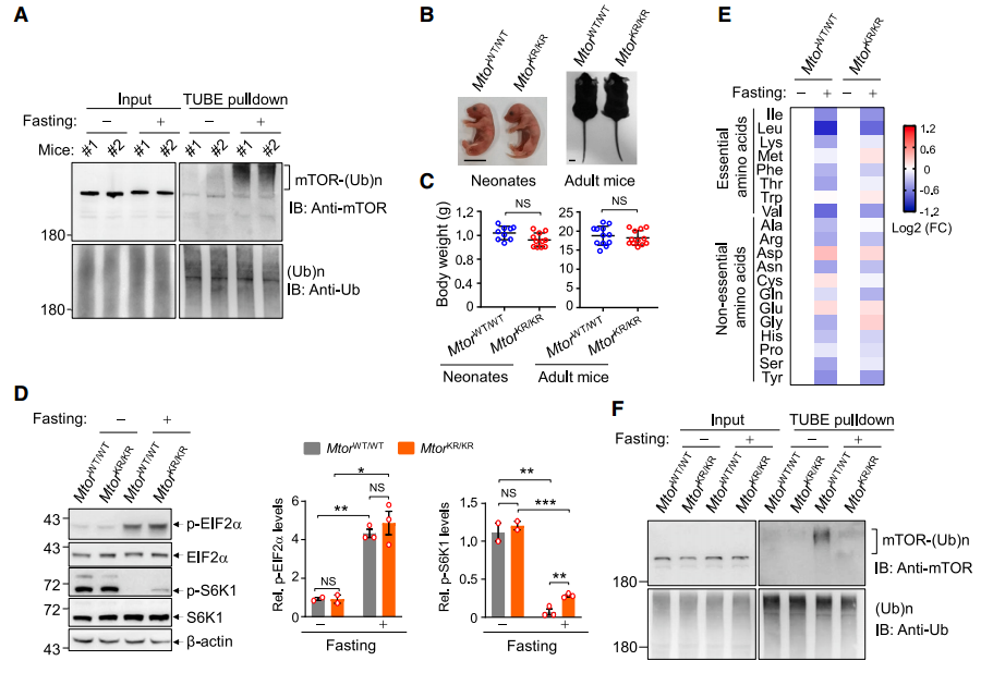 Cell Metab | mTORC1泛素化介导氨基酸感应的普适性机制 - 知乎