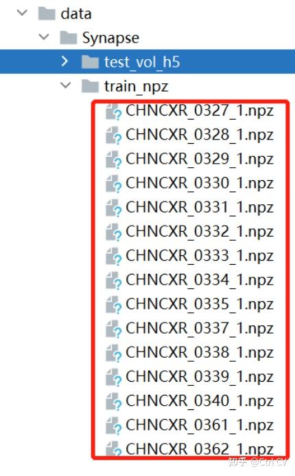 Swin-Unet训练自己的数据集 - 知乎