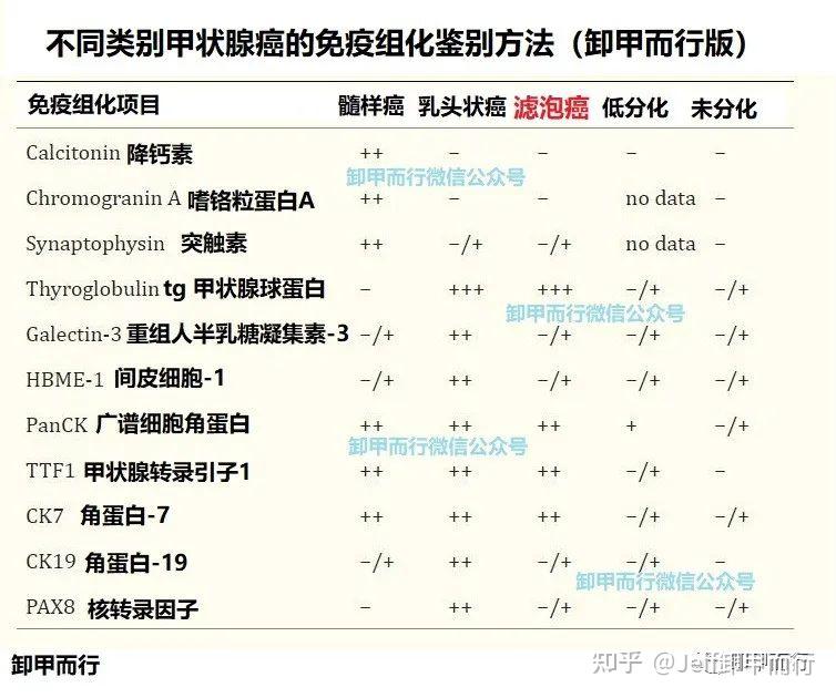 11-2：有望长期幸存！再谈低分化甲状腺癌（PDTC）的诊断与治疗 - 知乎