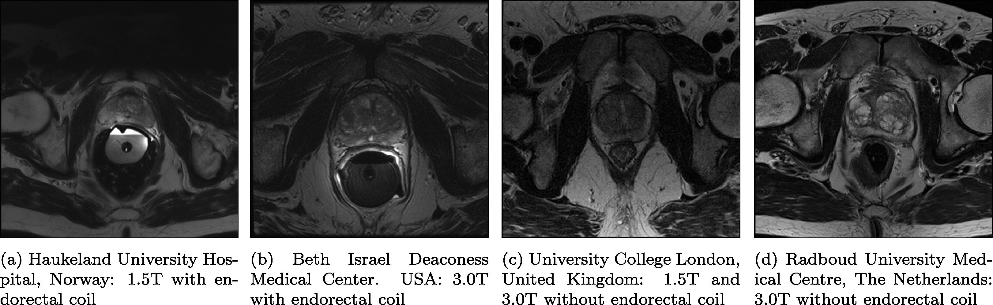PROMISE12 经典 MR 图像前列腺分割数据集介绍 - 知乎