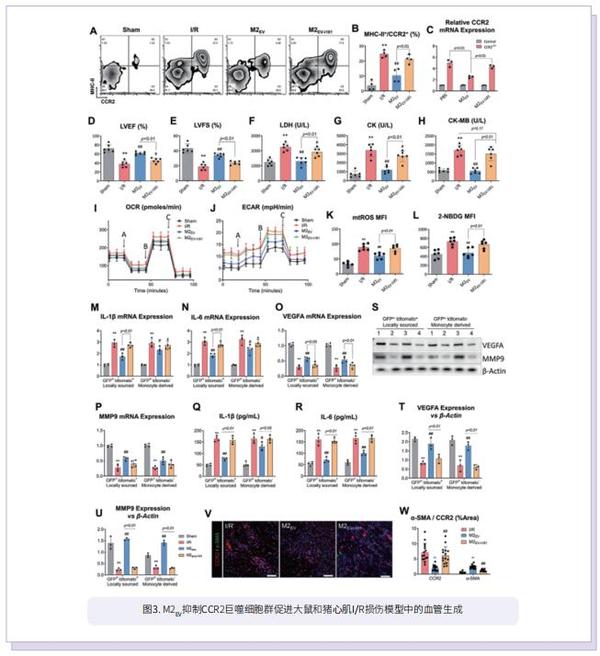 文献解读 | M2巨噬细胞衍生的sEV调节促炎CCR2+巨噬细胞亚群有利于AMI后心脏修复 - 知乎