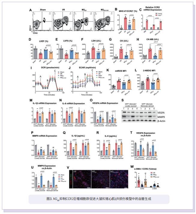文献解读 | M2巨噬细胞衍生的sEV调节促炎CCR2+巨噬细胞亚群有利于AMI后心脏修复 - 知乎