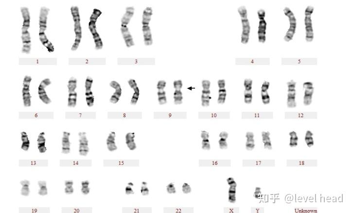 染色体多态性和数目变异 - 知乎