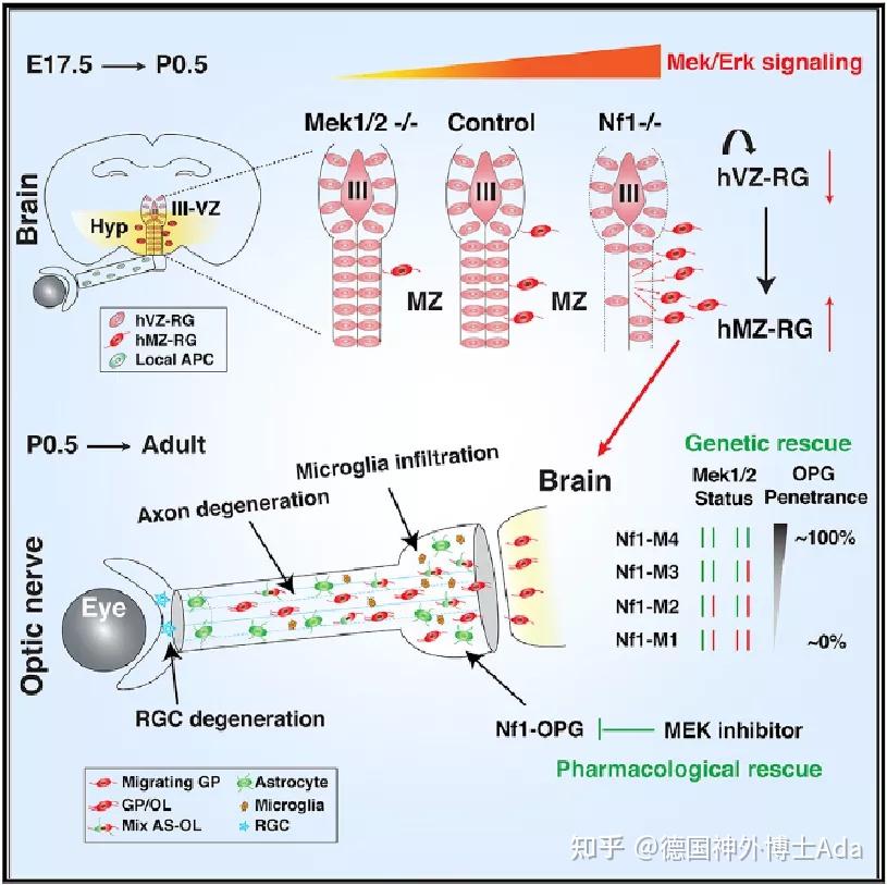 Developmental Cell：研究人员发现关键发育时期治疗可预防NF1相关视通路胶质瘤的发生 - 知乎