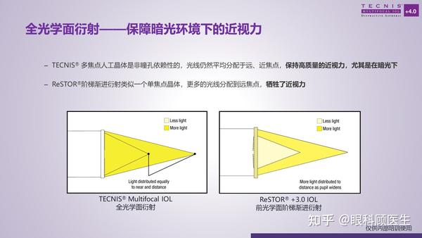 眼力健双焦点人工晶体-ZMB00的特点 - 知乎