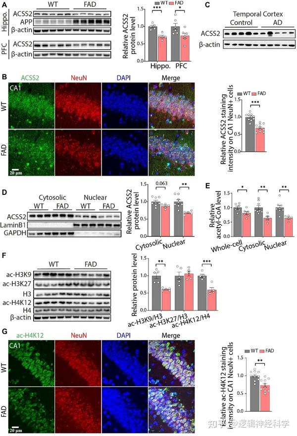 MN︱福建医科大学陈晓春/张静团队揭示ACSS2介导组蛋白乙酰化在阿尔茨海默病认知功能调控中的重要作用 - 知乎