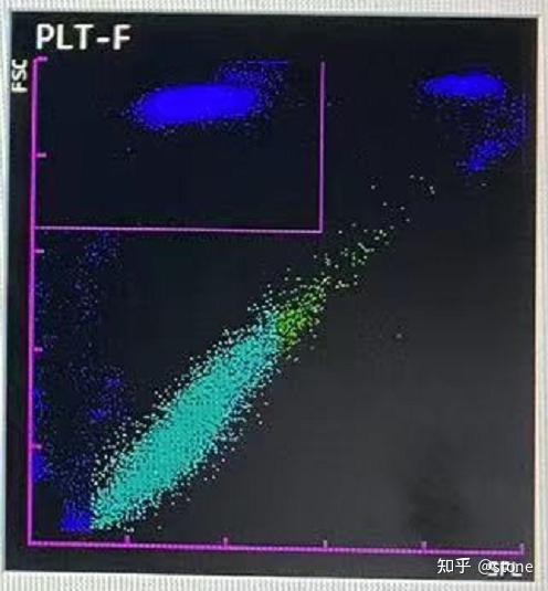 PLT检测-Sysmex血球仪三种不同检测方法 - 知乎