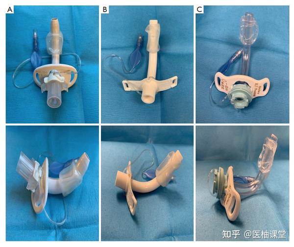 ICU的经皮气管切开术 - 知乎