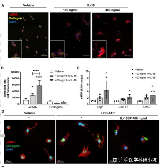Hepatology: IL-18信号通路促进小鼠肝纤维化中肝星状细胞的激活 - 知乎