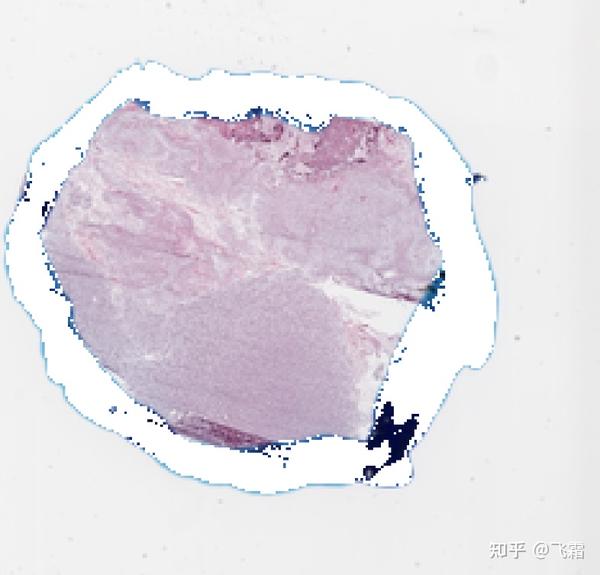 医学图像实战：病理学WSI图像的预处理 - 知乎
