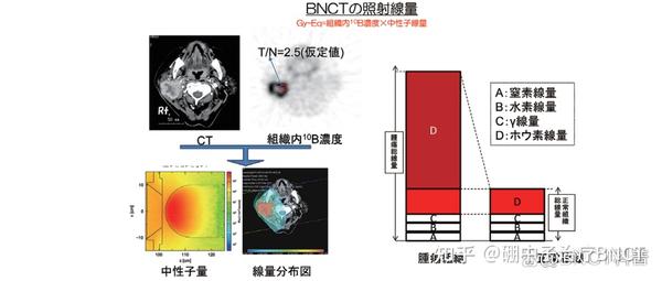 日本BNCT最新临床治疗数据出炉 - 知乎