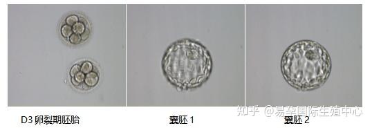 6AA、5BB、4AA、4BC胚胎等级等都是代表什么意思呢？—易孕国际 - 知乎
