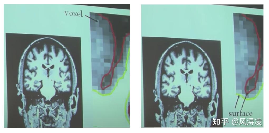 freesurfer下载安装，常用术语和recon-all命令 - 知乎