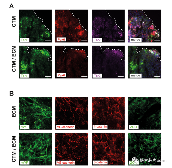 【器官芯片】血脑屏障模型模拟新皮质发育中神经炎症的影响 - 知乎