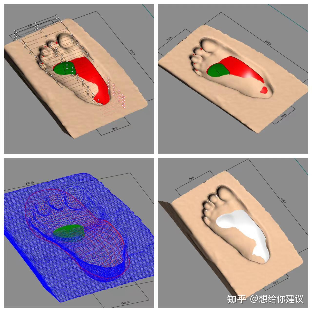 定制3D矫形鞋垫怎么避坑（3D技术篇） - 知乎