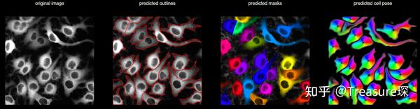 ImageJ实用教程——基于cellpose的不规则细胞分割（案例分析篇） - 知乎