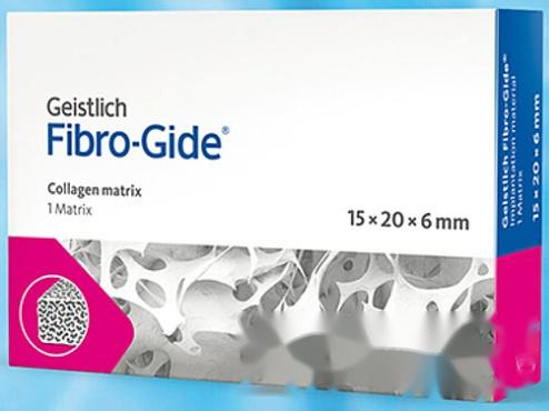 骨再生大咖：瑞士盖氏的故事 - 知乎