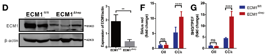 Gastroenterology | 南模生物助力揭示ECM1在肝纤维化疾病进展中的调控机制和功能 - 知乎