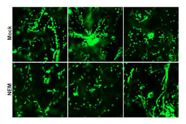 生信工具教程 | 如何用ImageJ自由调整显微照片的标尺？ - 知乎