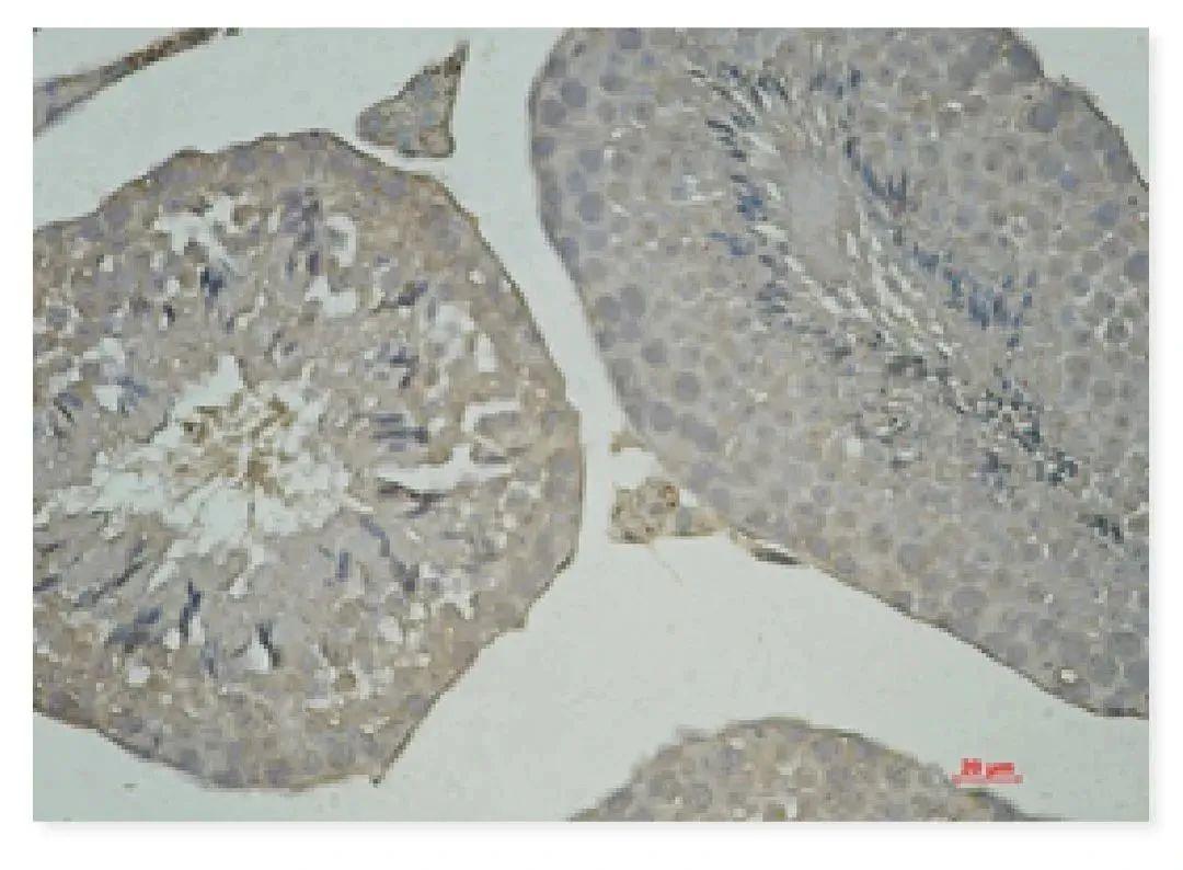 一抗二抗傻傻分不清？如何选择抗体？| MCE - 知乎