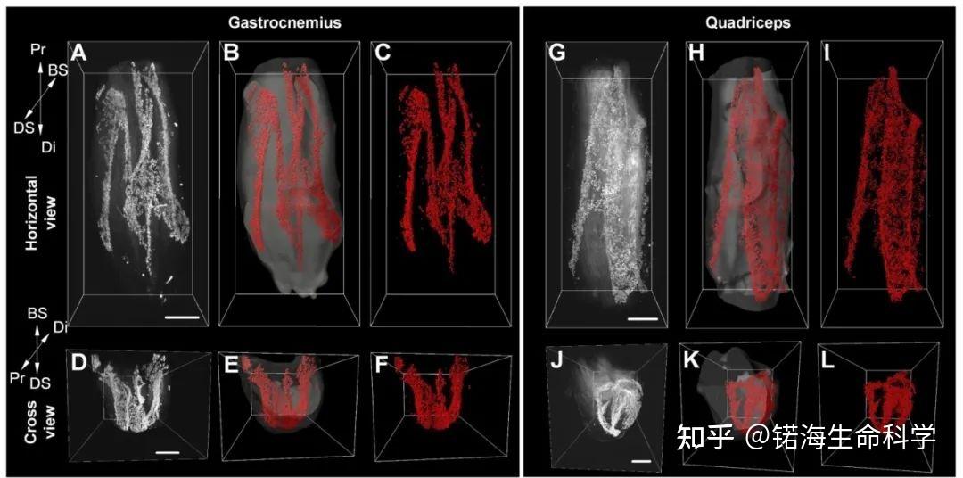 MEP：探究神经肌肉功能的重要桥梁 - 知乎