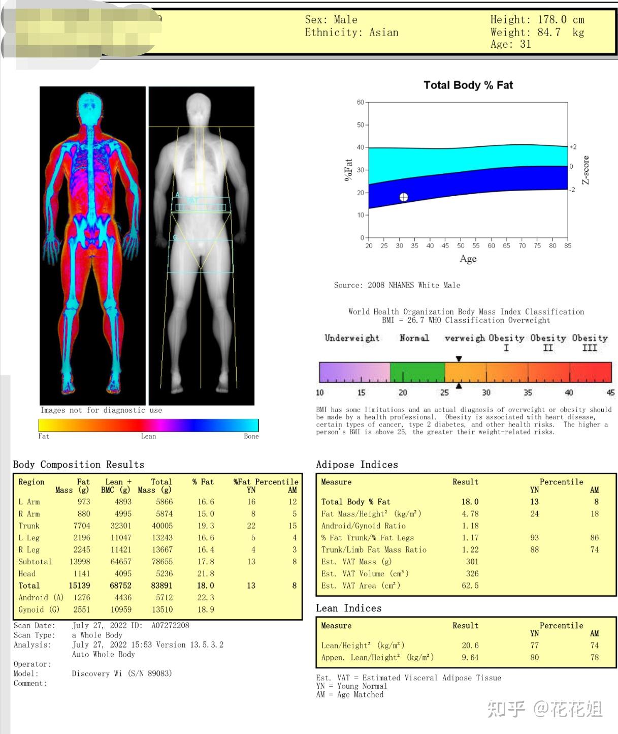 哪里可以测DXA，看自己的身体身份？ - 知乎