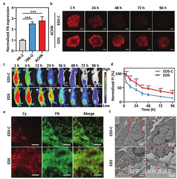 研究前沿｜逆转耐药 提高化疗敏感性！Adv. Mater：可转化的ECM剥夺系统有效抑制肾细胞癌 - 知乎