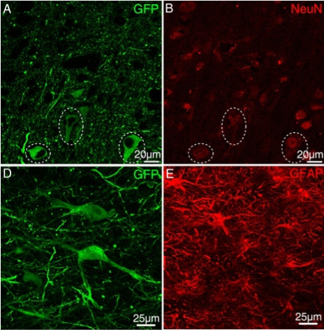 AAV、VSV和 LV在猕猴上的应用 - 知乎
