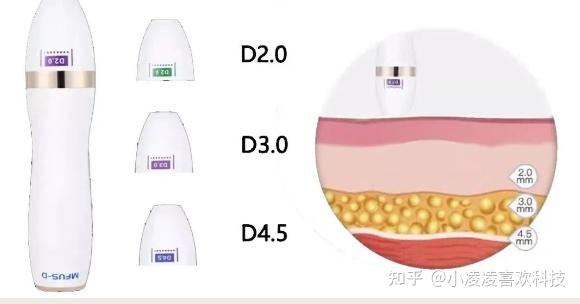 分析超声炮脸肿几天会消退、超声炮间隔多久做一次~ 知乎