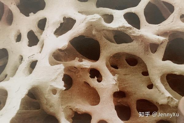 Inside bones 02 – spongy bone - 知乎