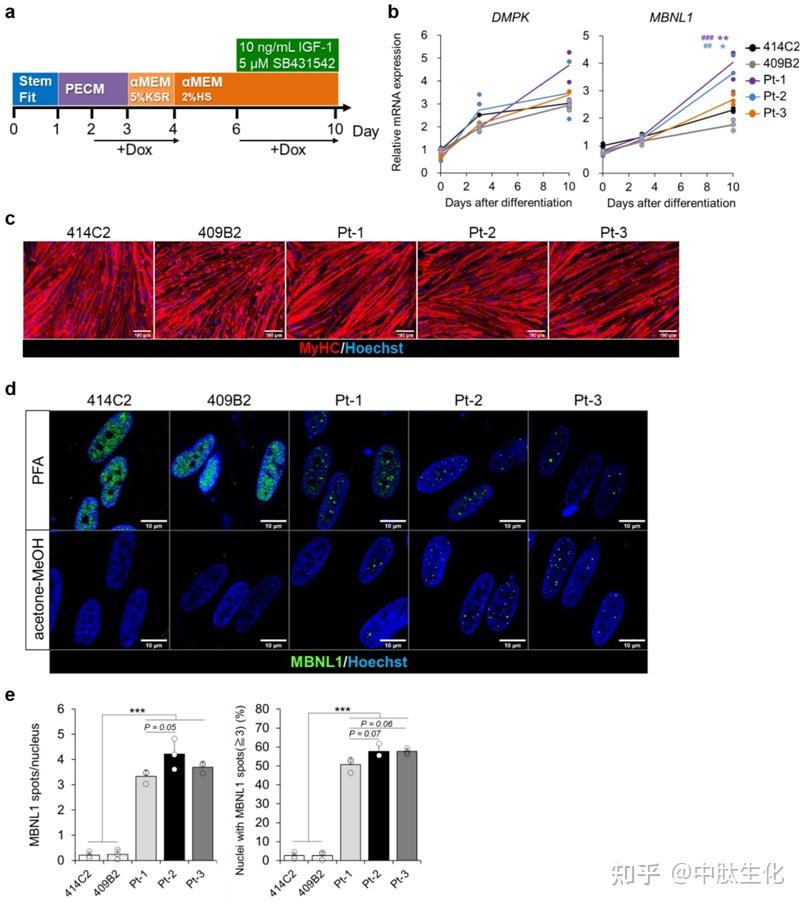 Nature子刊：利用患者来源的iPS细胞重现强直性肌营养不良1型的骨骼肌病理 - 知乎