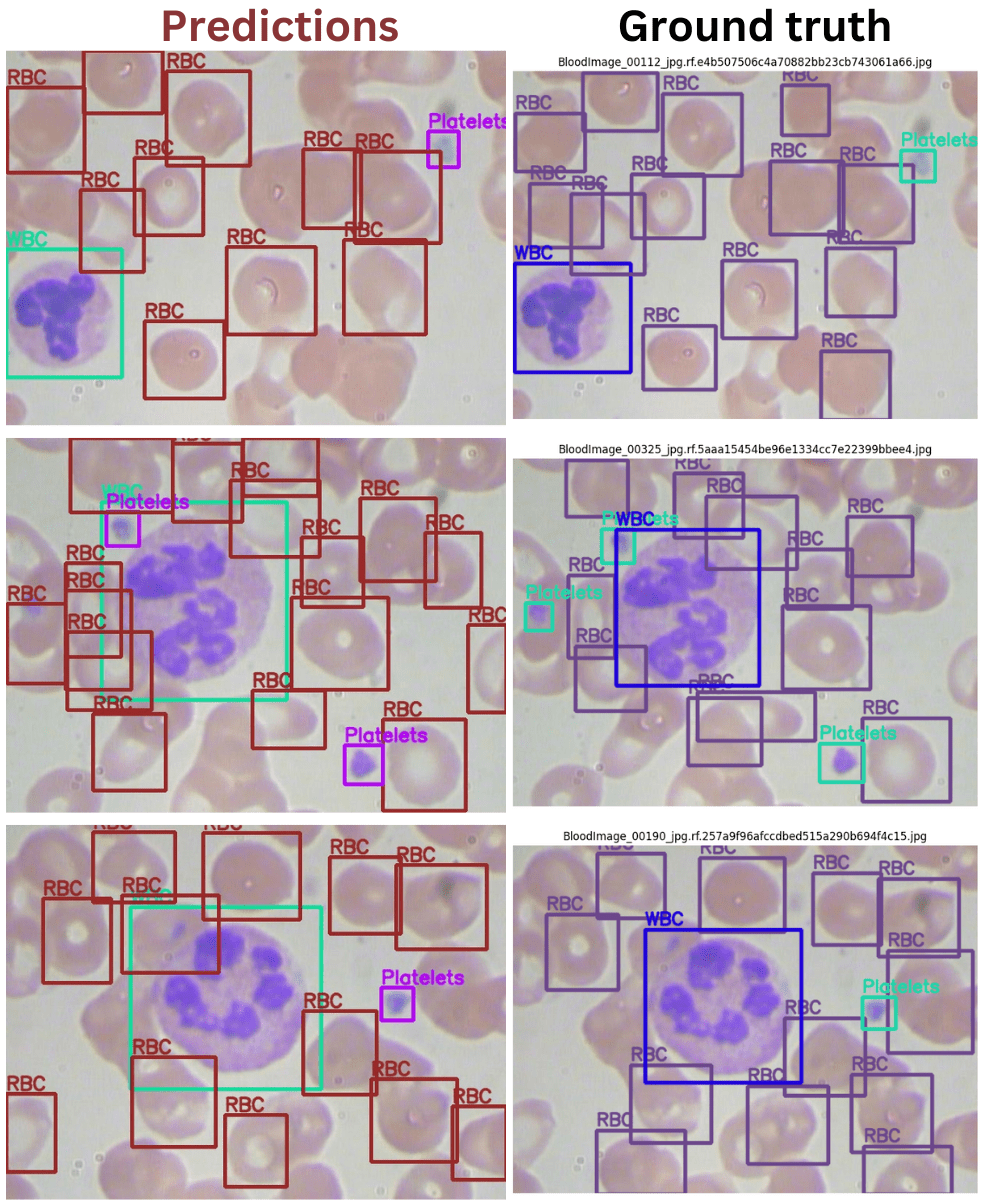 在自定义数据集上训练RetinaNet（ 基于PyTorch ） - 知乎