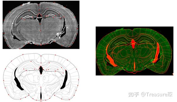 MATLAB科研图像处理——手动脑片图谱配准 - 知乎