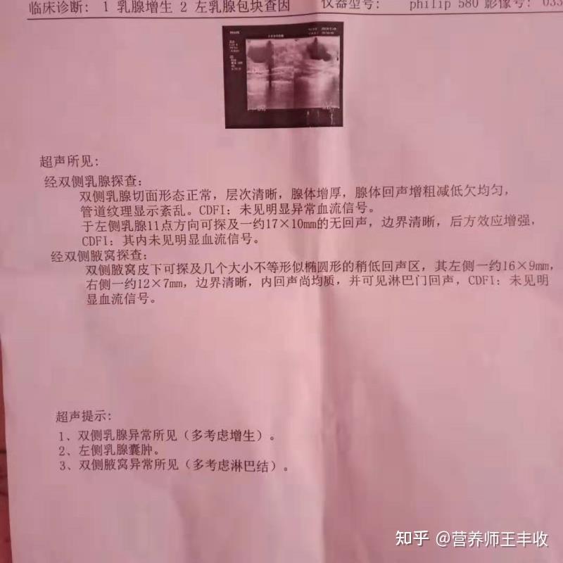 我们来了解一下，到底乳腺疾病是怎么形成的？ 知乎