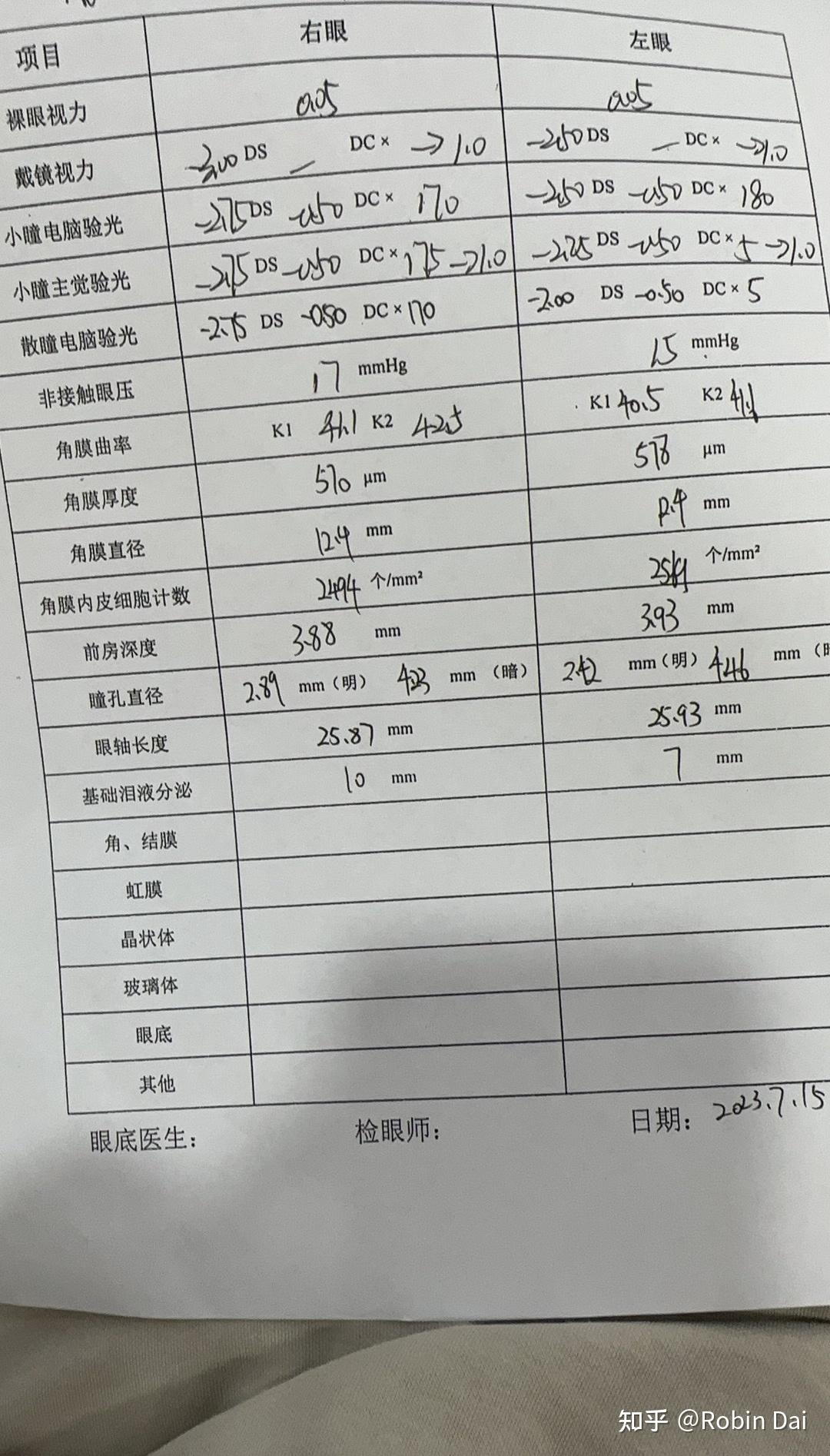 公立医院LASEK表层手术记录 - 知乎