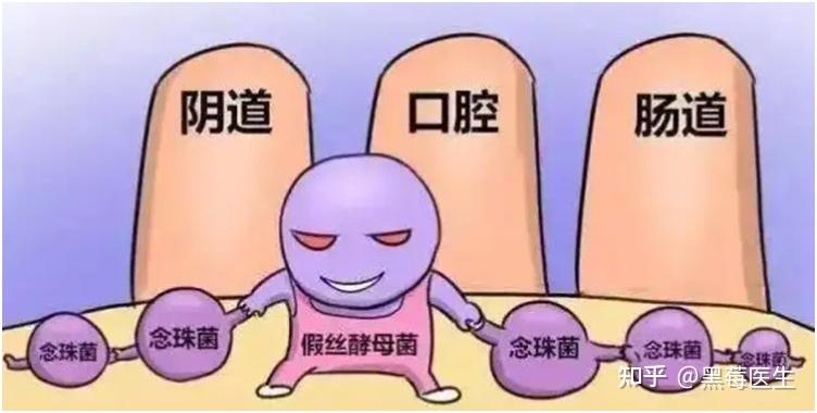下体异常瘙痒，大概率是阴道炎，对照以下症状看自己有无 知乎