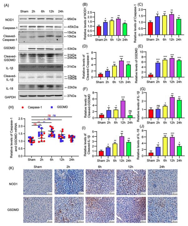 华西新刊丨MedComm丨NOD1诱导细胞焦亡加重小鼠肝脏缺血再灌注损伤 - 知乎