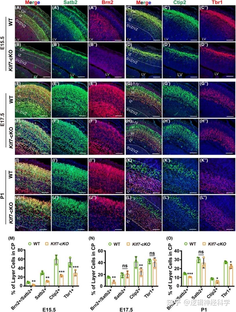 Brain Pathol︱复旦大学秦松课题组揭示转录因子KLF7调控大脑皮层神经元迁移以及胼胝体的形成的作用和机制 - 知乎