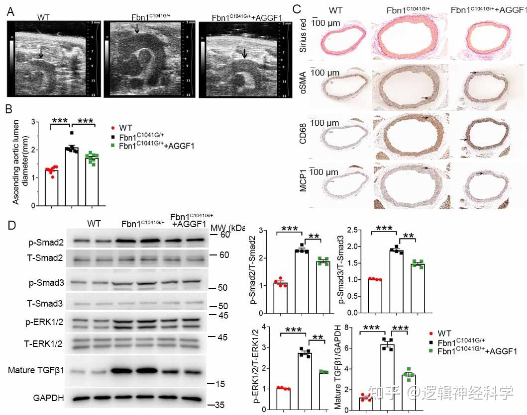 Nat Commun｜华中科技大学王擎课题组发现治疗胸主动脉瘤新策略 - 知乎