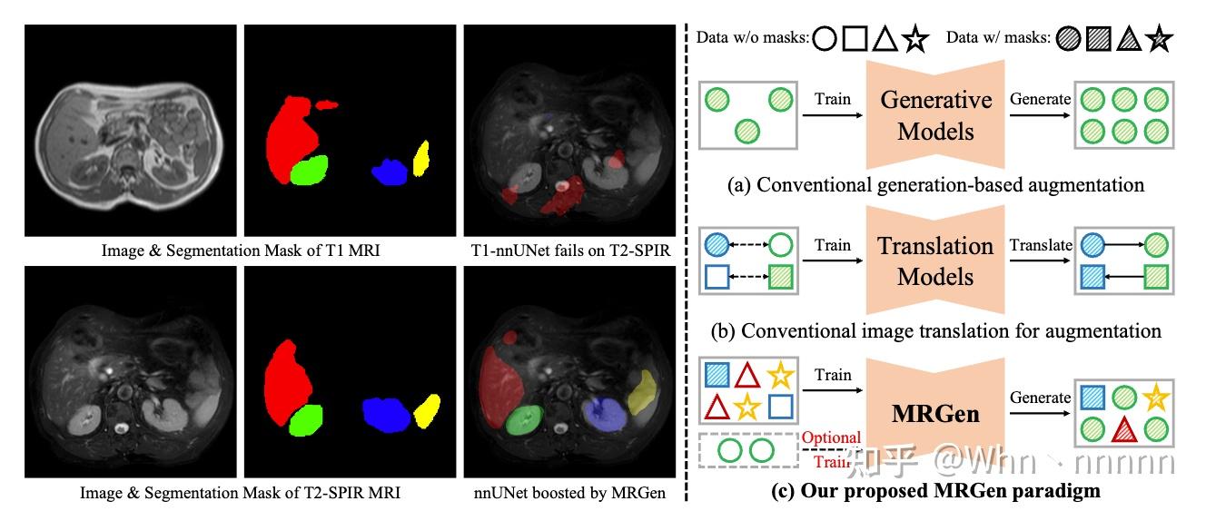 [ICCV 2025] MRGen: 针对稀缺MRI模态的分割数据生成引擎 - 知乎