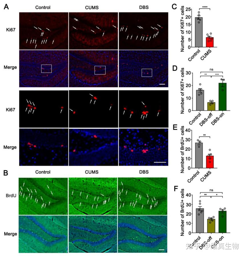 摆脱抑郁，拥抱阳光！NAc-DBS疗法为抑郁症治疗提供新思路！ - 知乎
