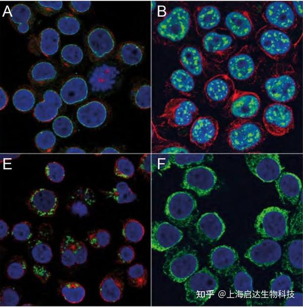 总结很齐全：悬浮细胞的免疫荧光染色 - 知乎