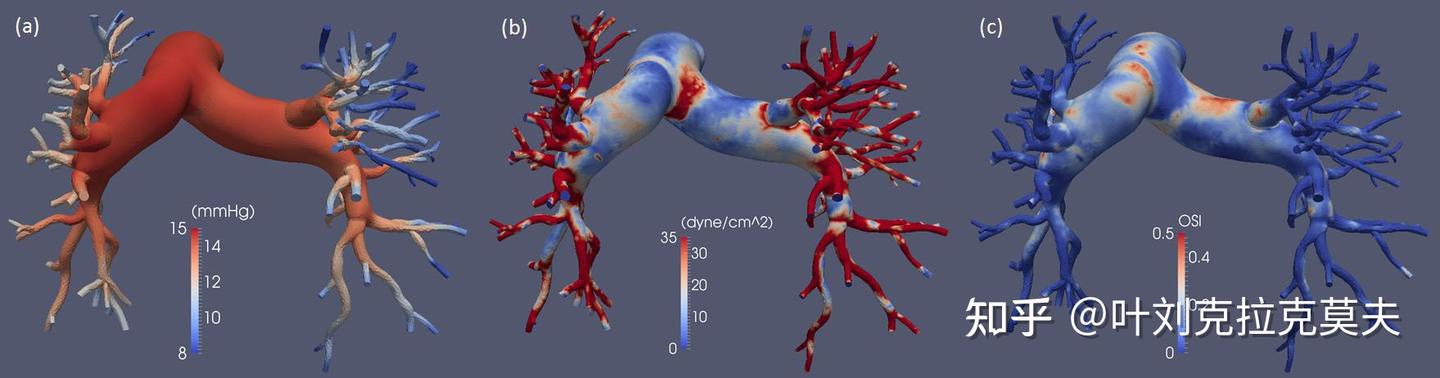 开源科学工程技术软件介绍 – 血流模拟和分析软件Simvascular - 知乎