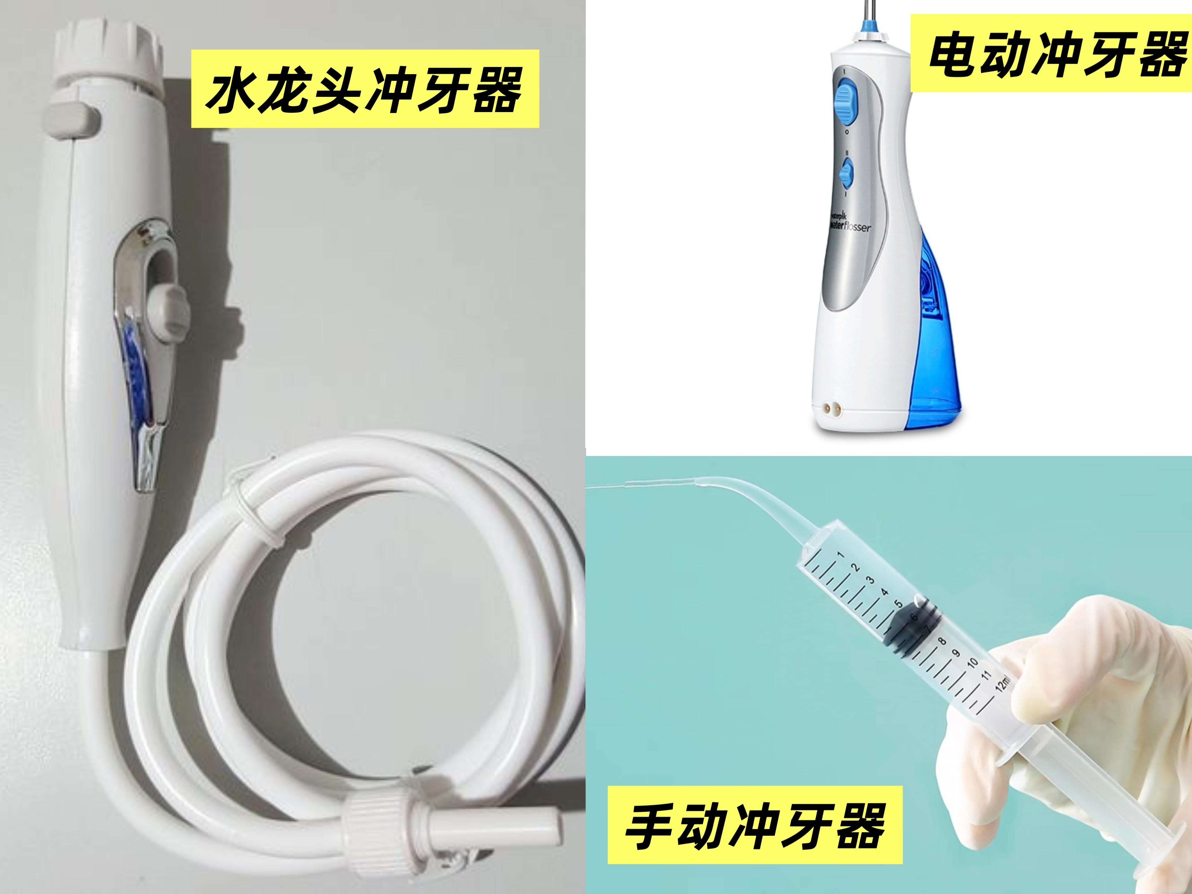 2025冲牙器推荐｜口碑最好冲牙器排名：usmile、奇异鸟、飞利浦、倍至实测大PK，谁才是性价比之王？ - 知乎
