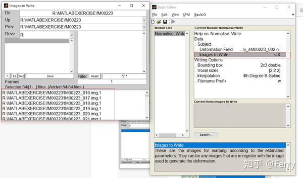 fMRI静息态功能性核磁共振预处理图解 - 知乎