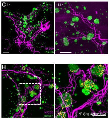小而不凡的胰腺 —— 组织透明化应用 - 知乎