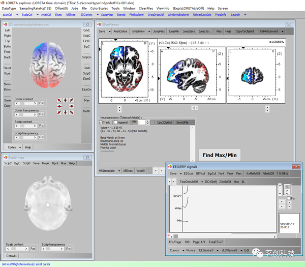基于LORETA的EEG静息态脑网络分析 - 知乎